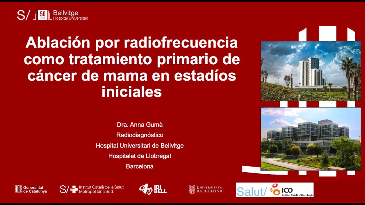 407- Ablación por radiofrecuencia como tratamiento primario de cáncer ...