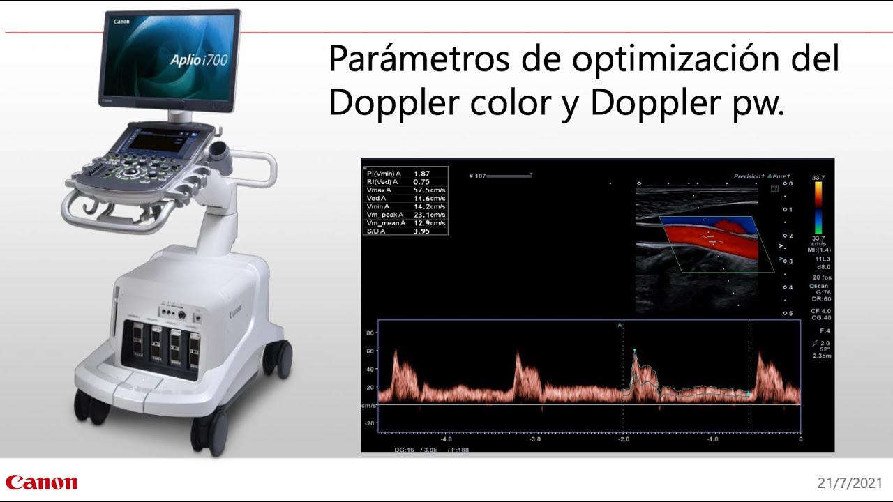 129- Optimización de los parámetros de Ecografía Doppler - Campus ...